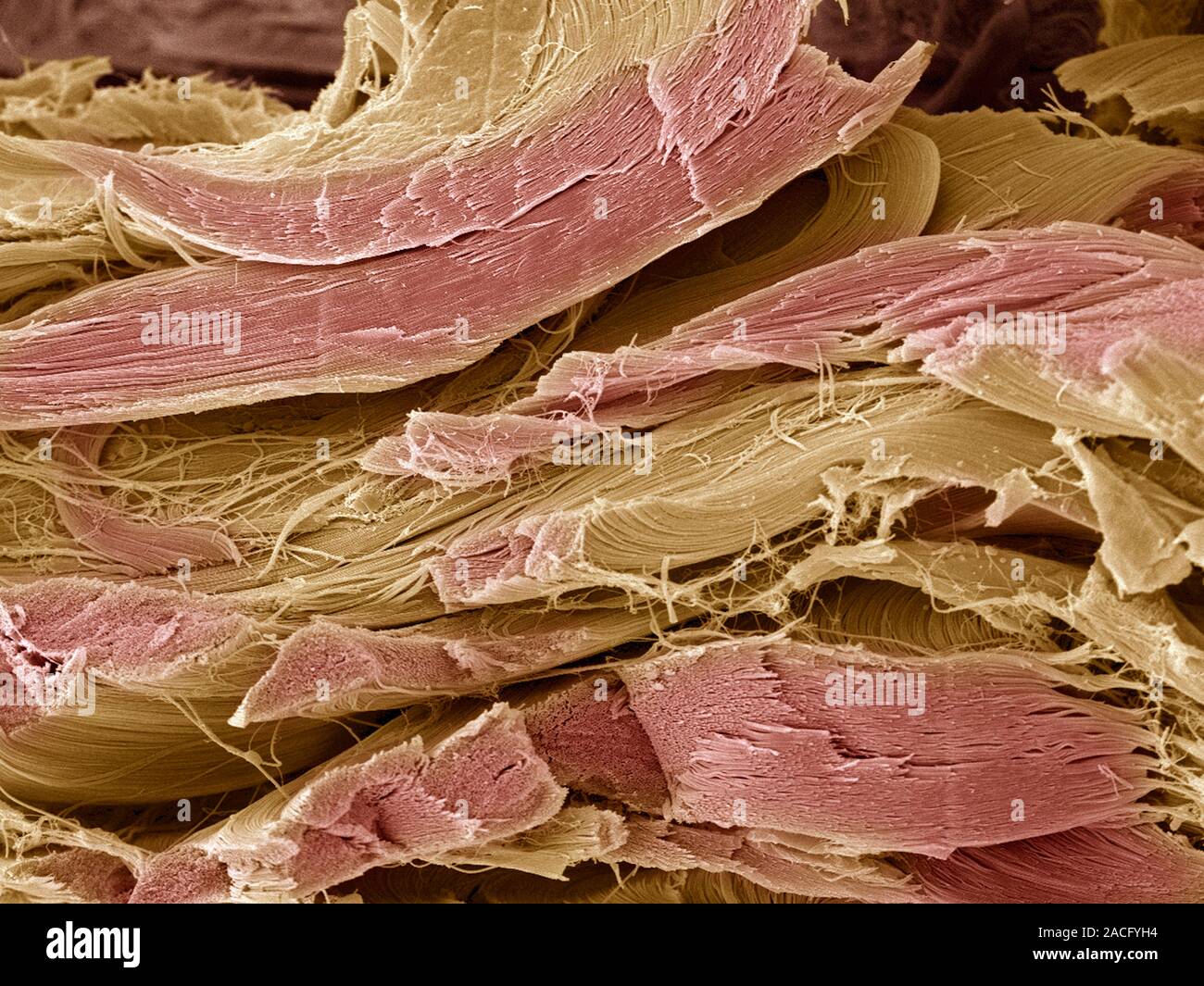 Tendon fibres. Coloured freeze-fracture scanning electron micrograph ... Tendon fibres. Coloured freeze-fracture scanning electron micrograph ...