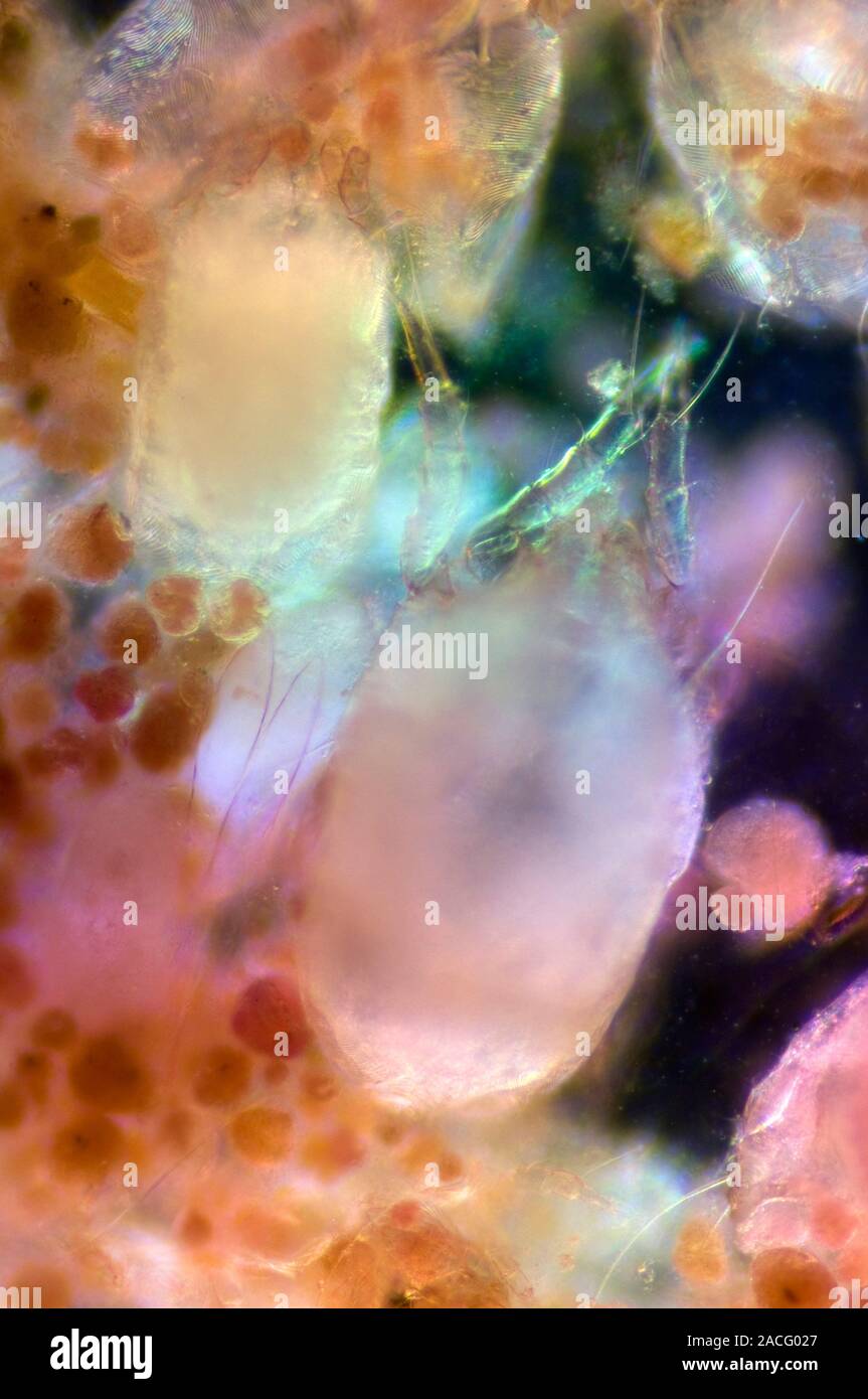House dust mite (Dermatophagoides pteronyssinus), light micrograph ...