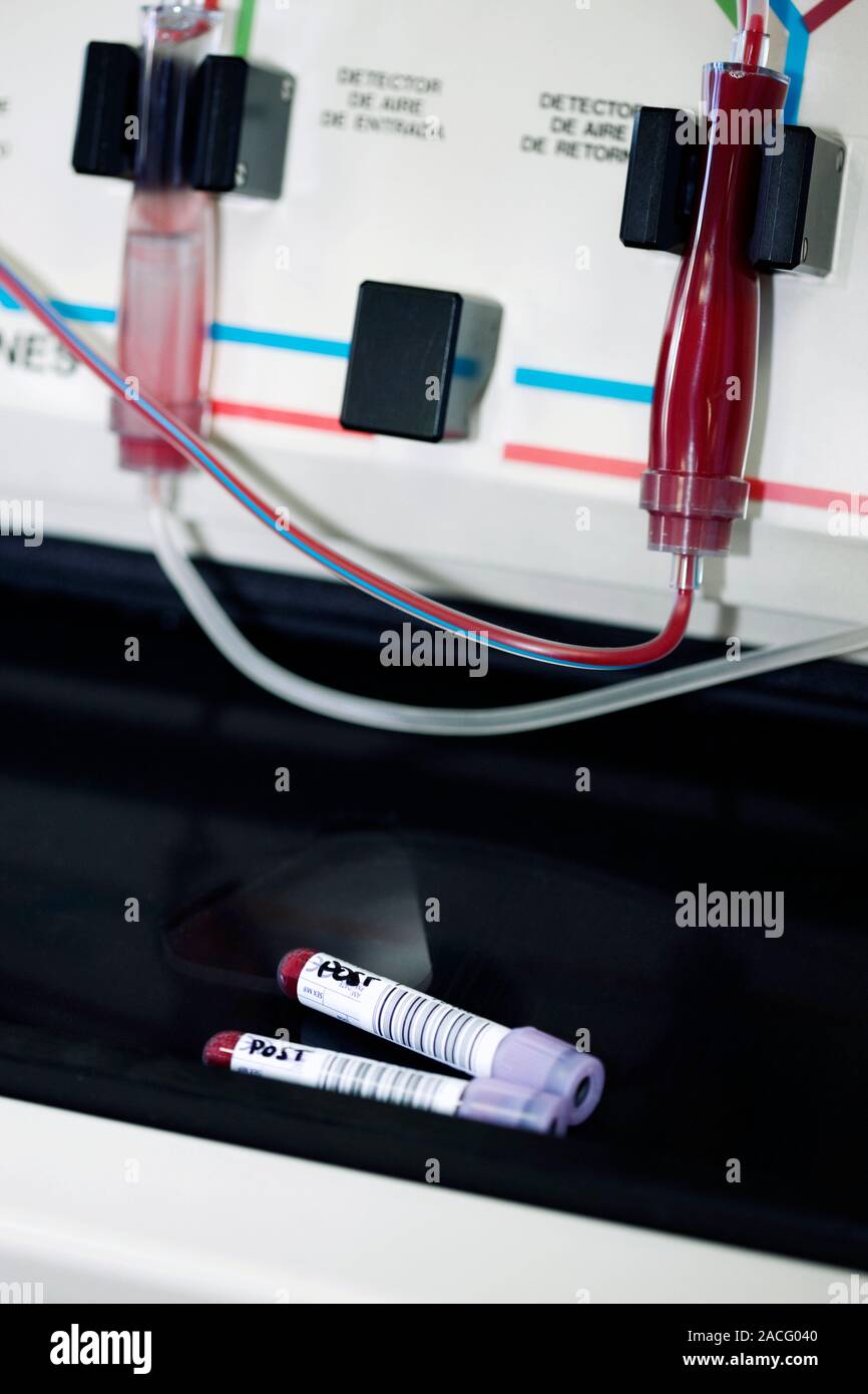 Blood apheresis machine. Machine used to separate blood into its ...