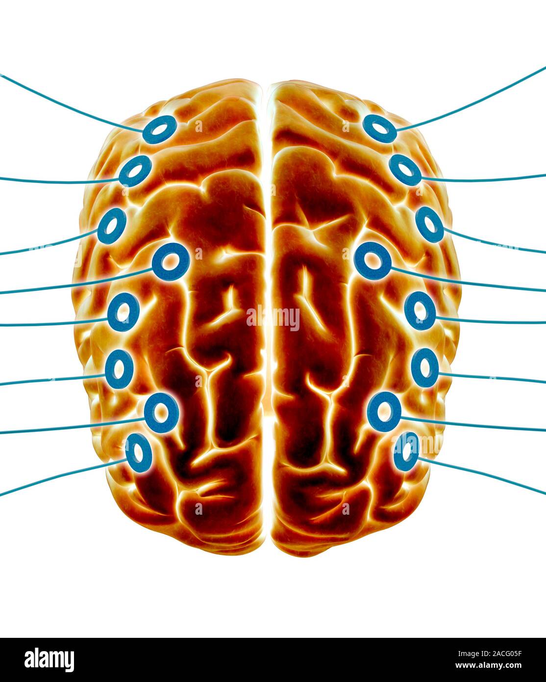 Electroencephalography. Computer artwork of the top of a brain with ...