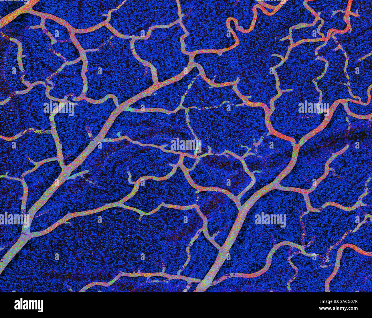 Brain blood supply. Confocal light micrograph of the superficial ...