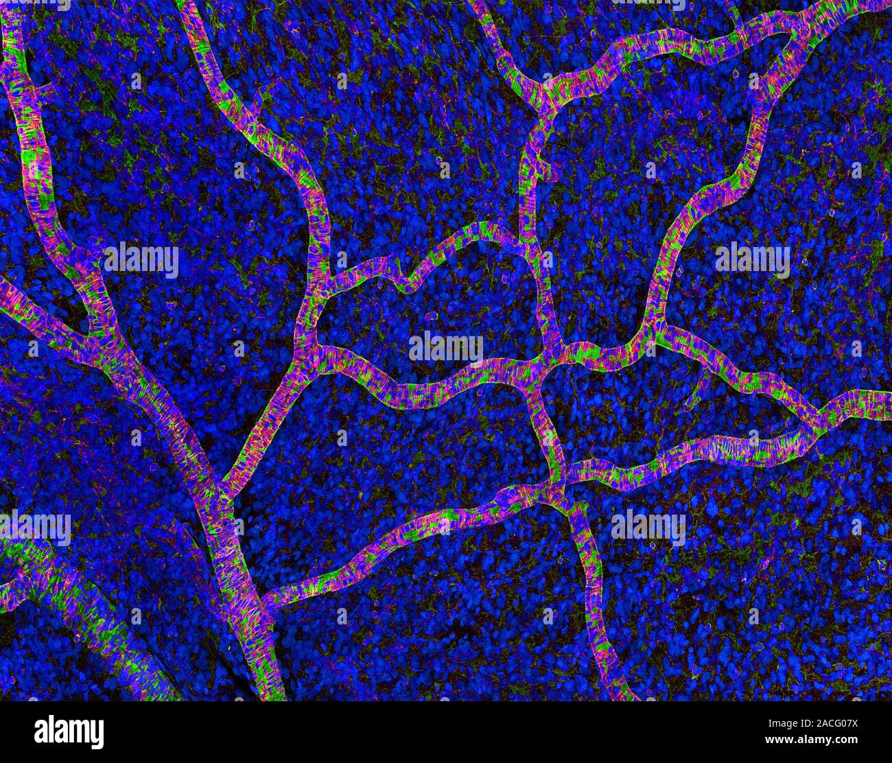 Brain blood supply. Confocal light micrograph of the superficial ...