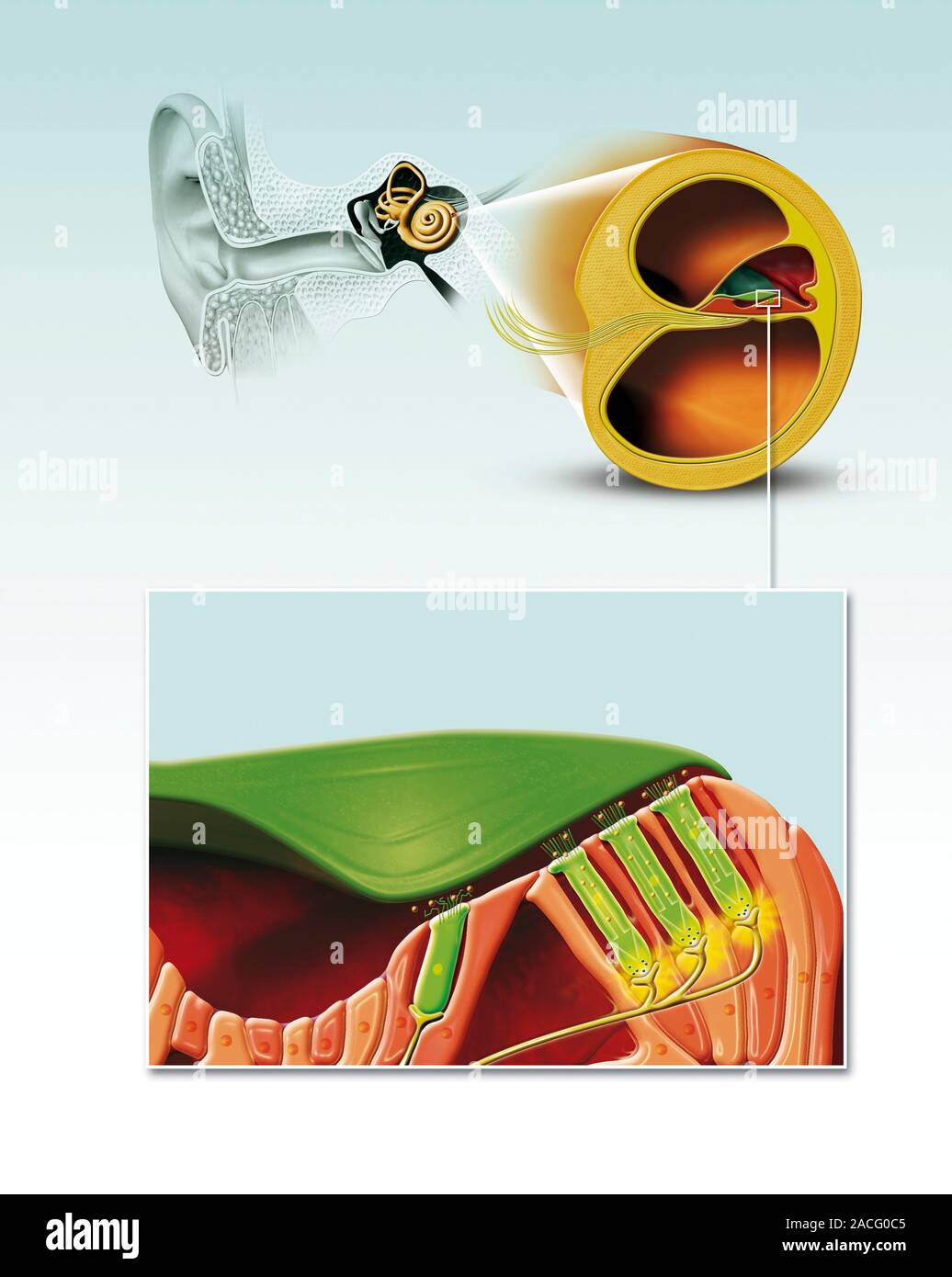 Damaged hearing. Computer artwork of the inner ear. At bottom is an ...