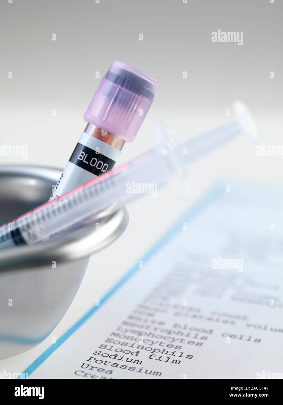 Medical testing. Syringe and blood sample in a kidney dish, next to a ...