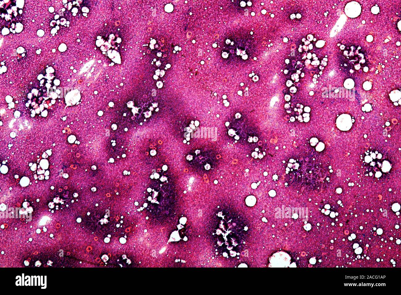 Human red bone marrow, light micrograph. Active haemopoietic (blood ...