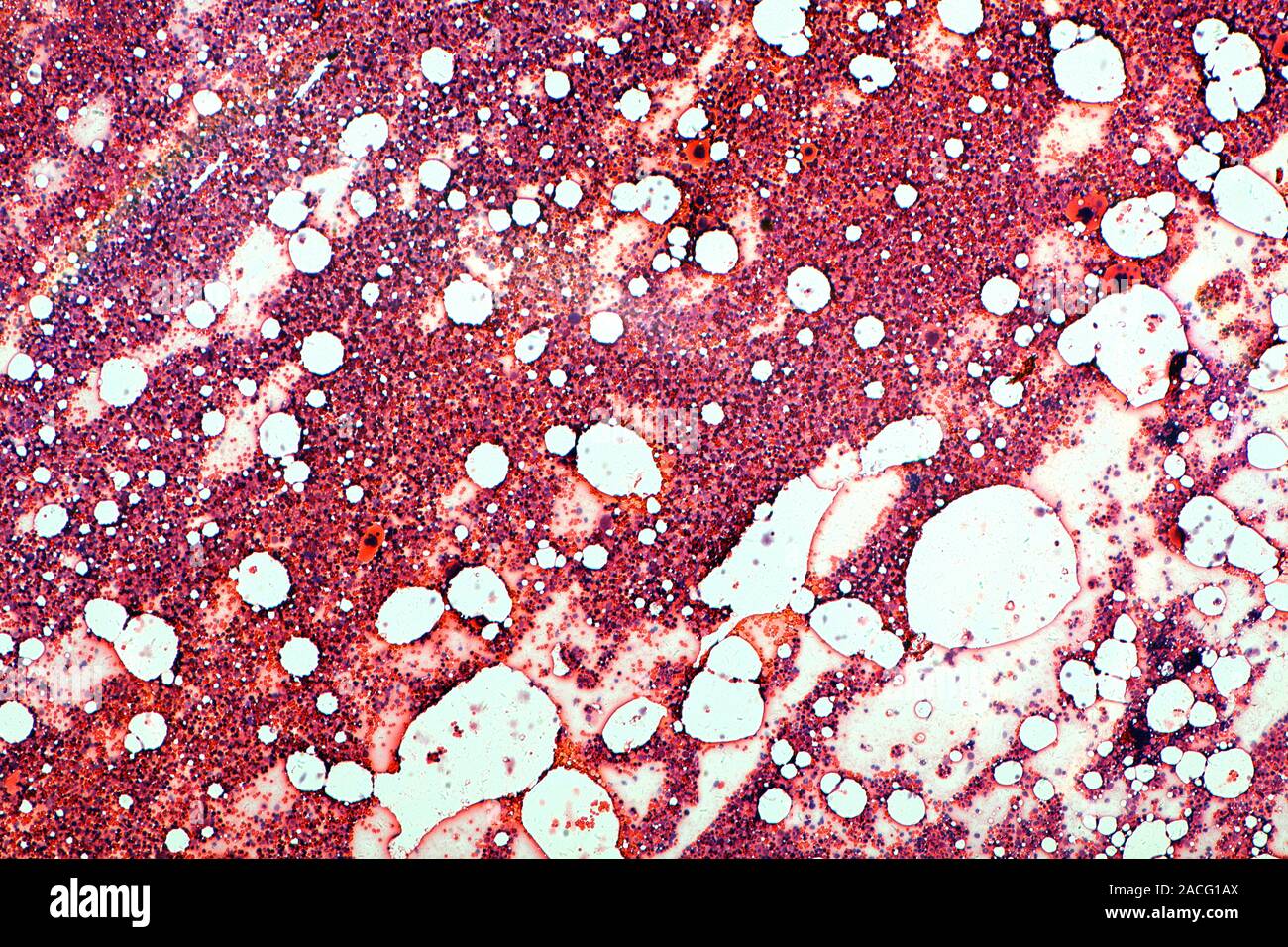 Human red bone marrow, light micrograph. Active haemopoietic (blood ...