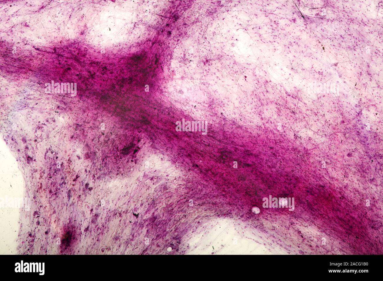 Loose connective tissue. Light micrograph of loose, or areolar ...