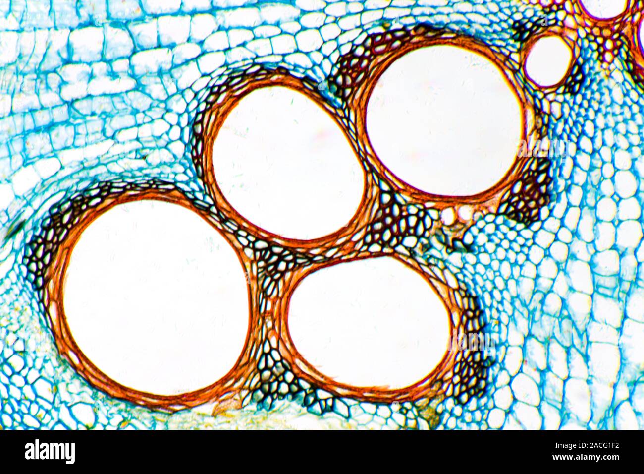Squash root. Light micrograph of a transverse section through a squash ...