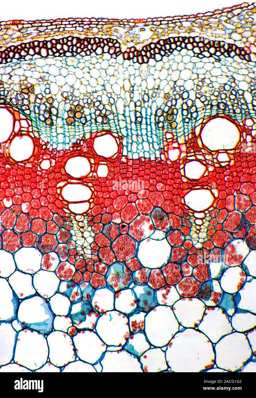 Kidney bean stem. Light micrograph of a section through the stem of a ...