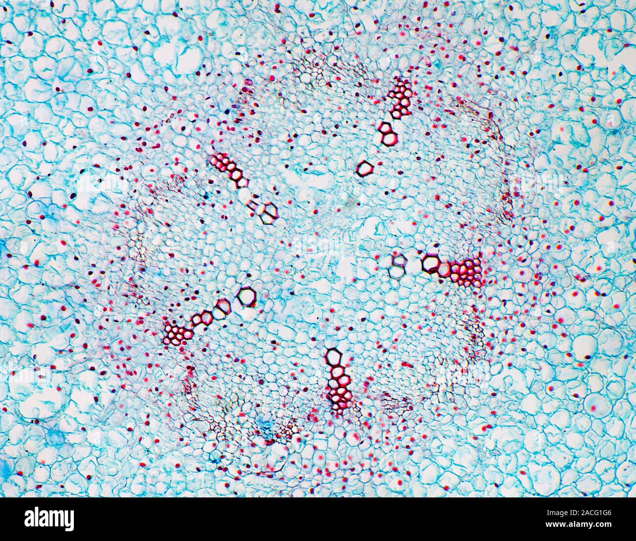 Broad bean root. Light micrograph of a transverse section through the ...