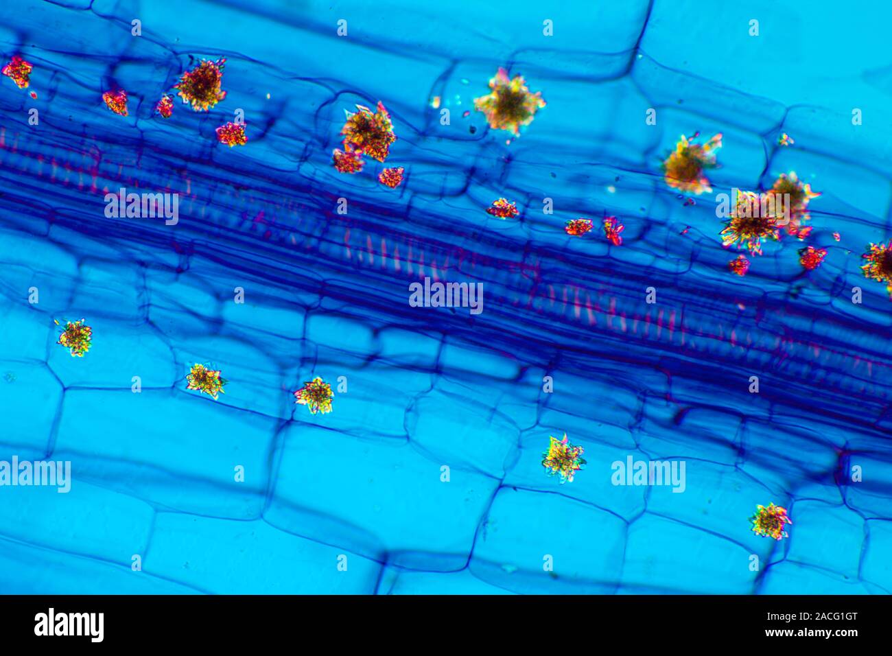 Rhubarb leaf. Polarised light micrograph of a longitudinal section ...