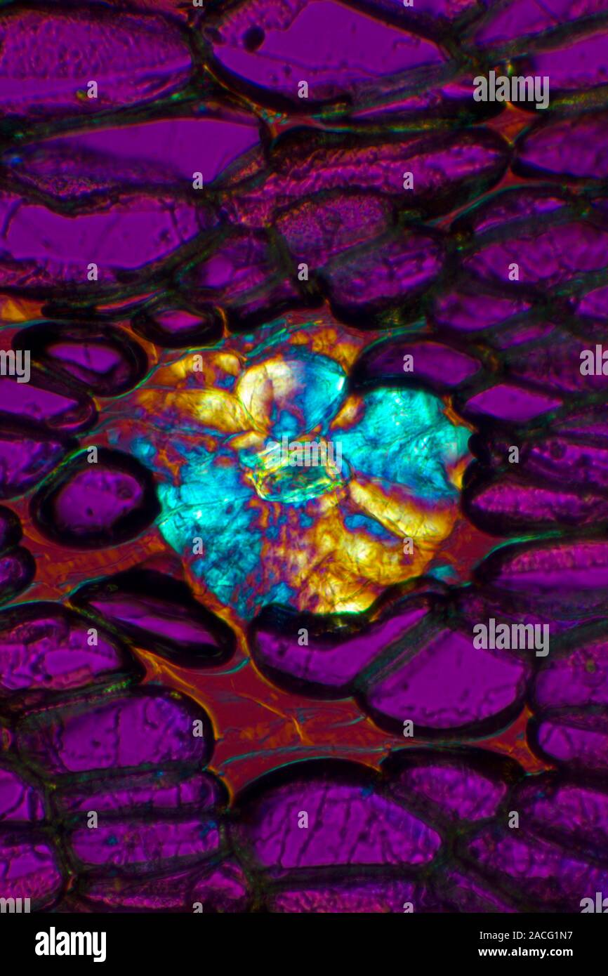 Inulin crystals. Polarised light micrograph of inulin crystals (centre ...