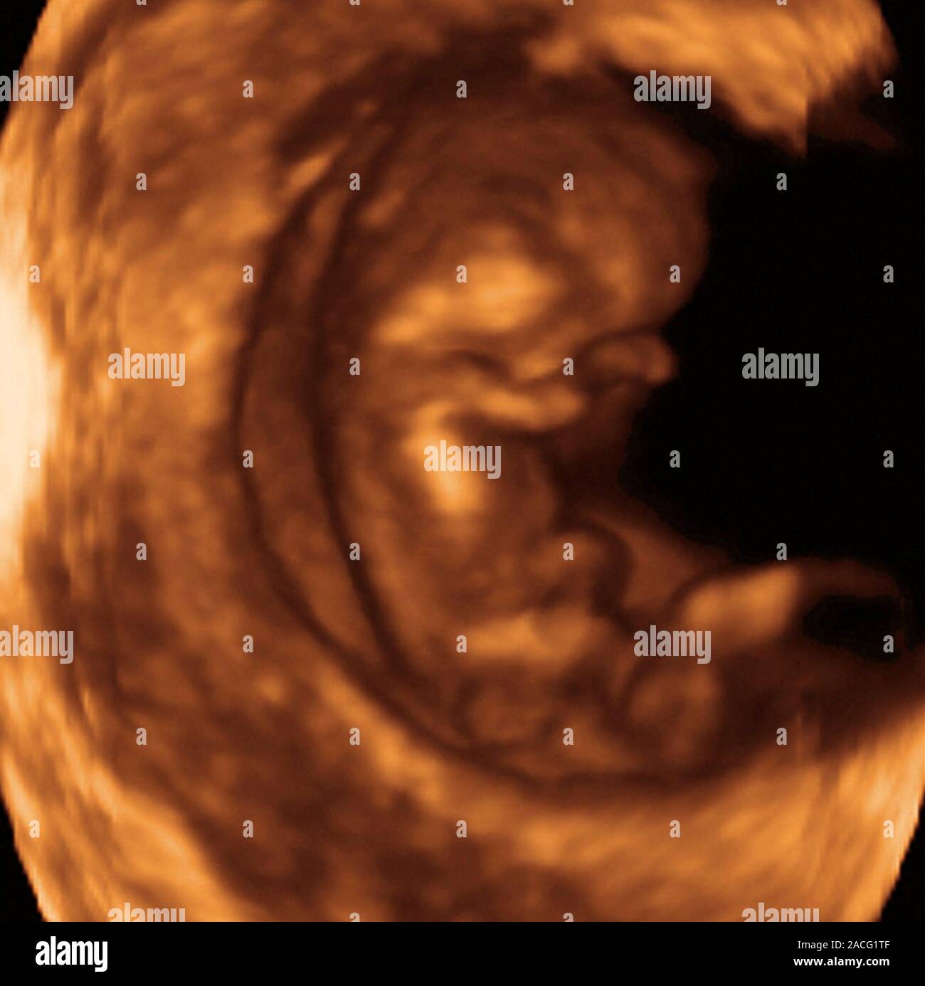 Foetus. Coloured 3-D ultrasound scan of a foetus at 12 weeks ...