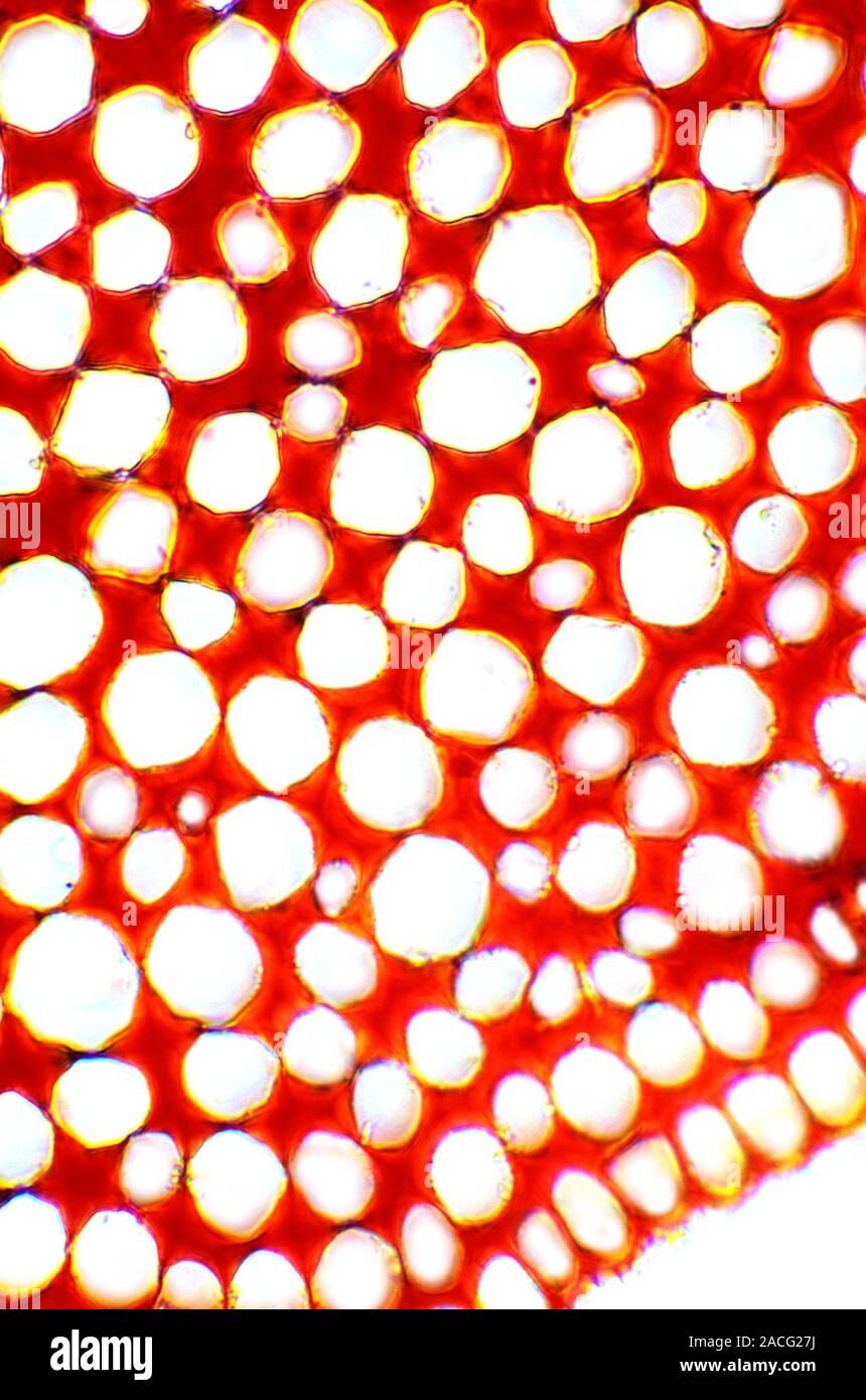 Collenchyma plant cells. Light micrograph of a transverse section ...