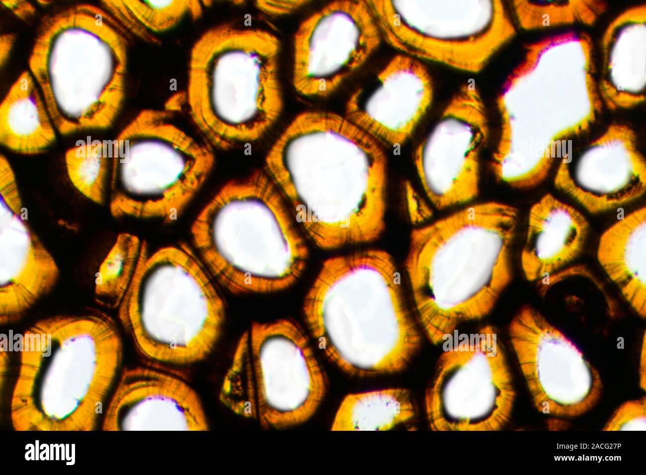 Plasmodesma plant cells. Light micrograph of a transverse section ...