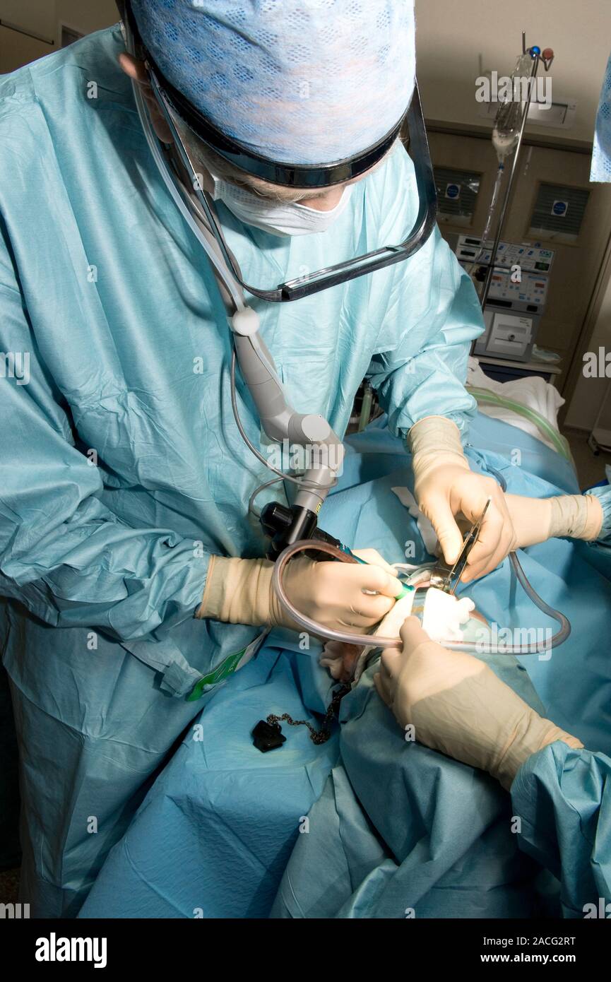 Mouth cancer surgery. Surgeons using a carbon dioxide laser to remove a ...