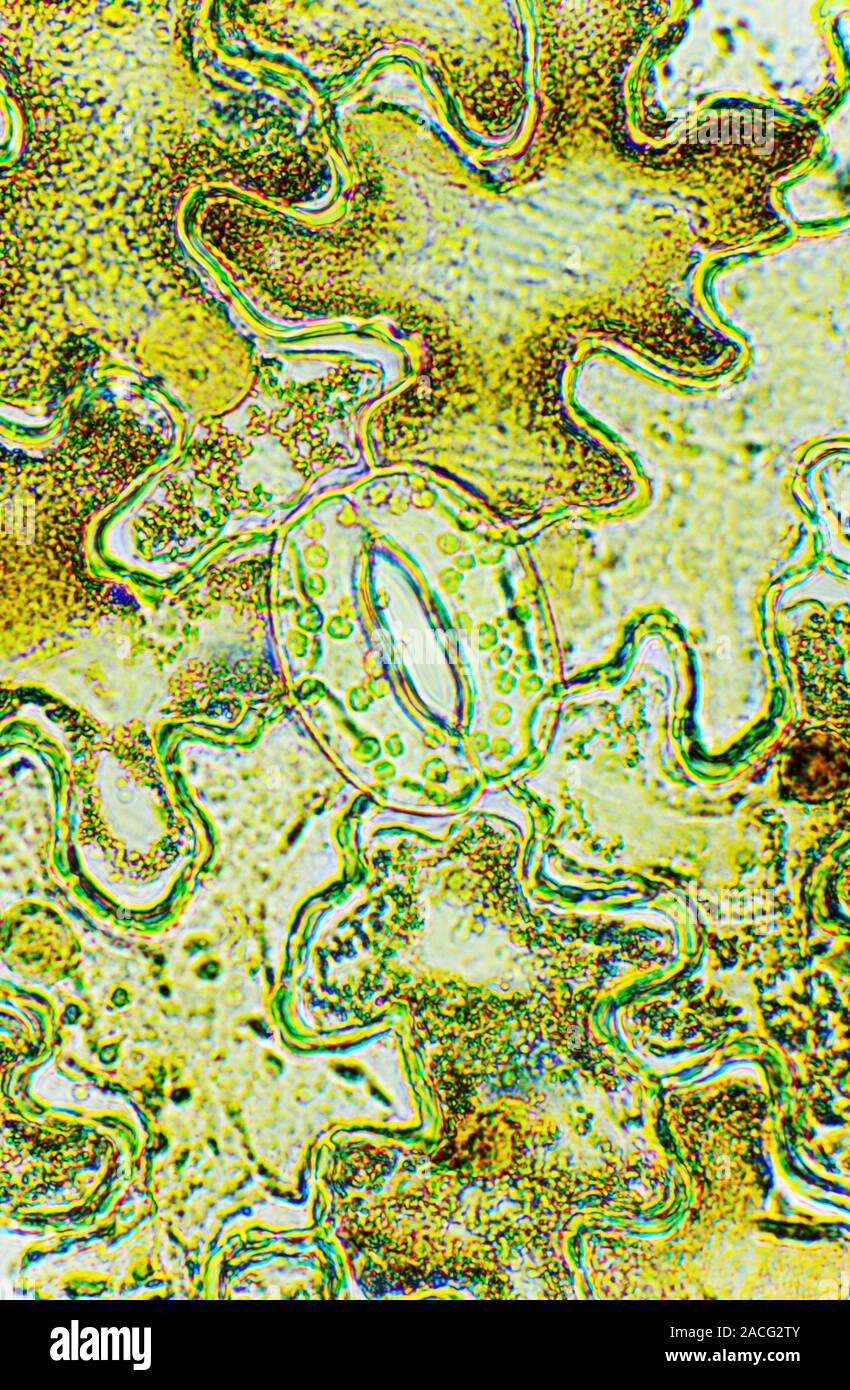 Plant stoma. Light micrograph of a stomatal pore (centre) on the ...