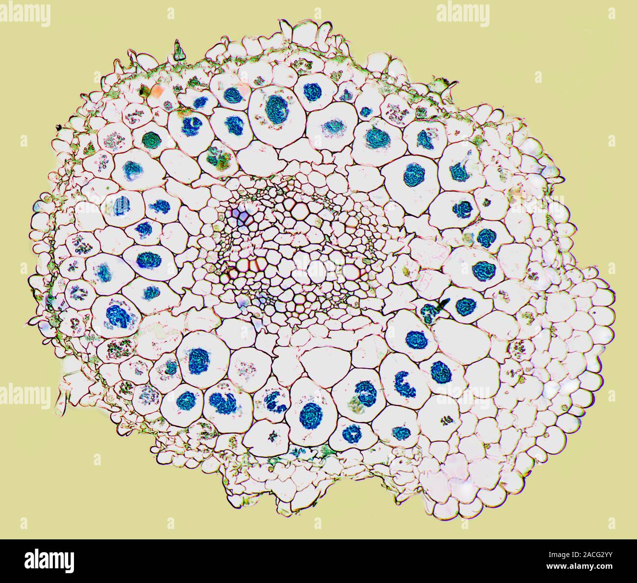 Root fungus. Light micrograph of a cross-section through a root ...