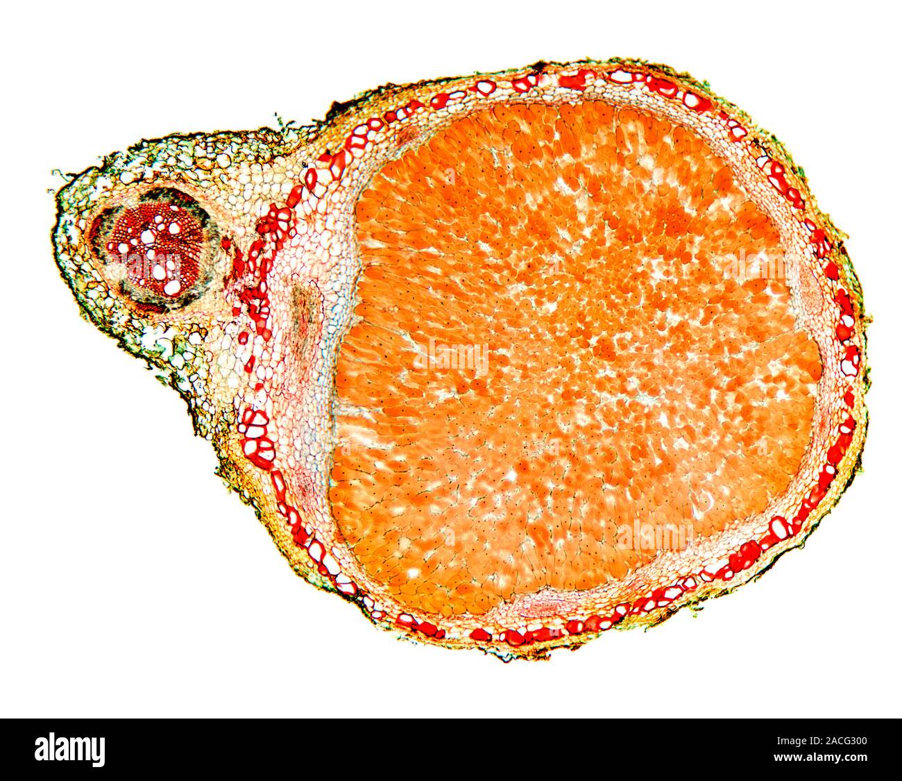 Nitrogen-fixing root nodule. Light micrograph of a section through a ...