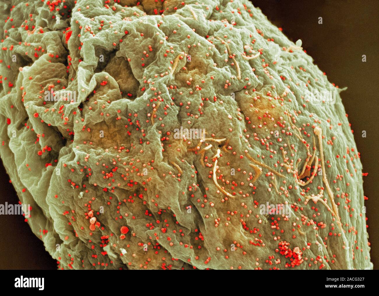 Cell infected with HIV. Coloured scanning electron micrograph (SEM) of HIV particles (red/orange ...