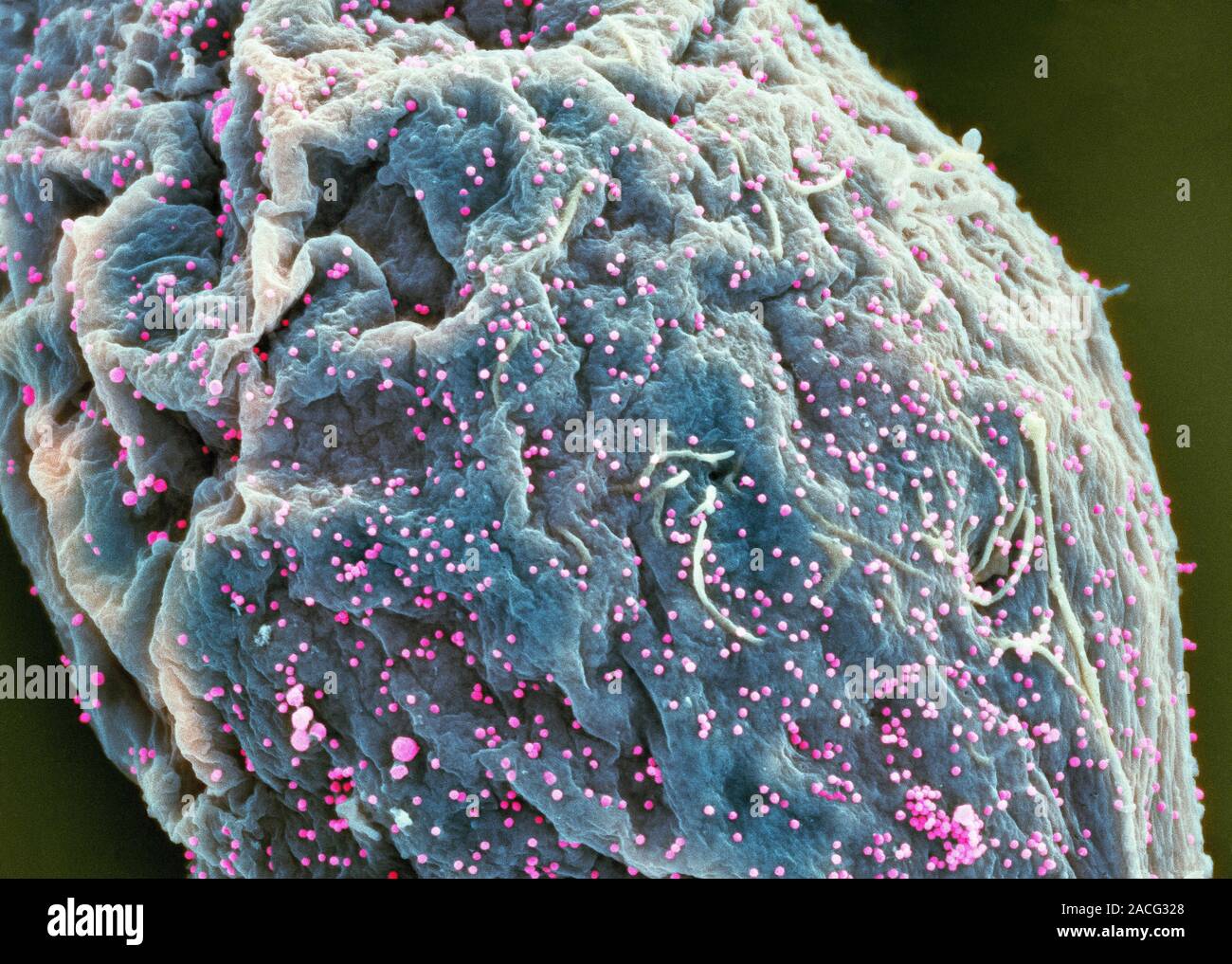 Cell infected with HIV. Coloured scanning electron micrograph (SEM) of ...
