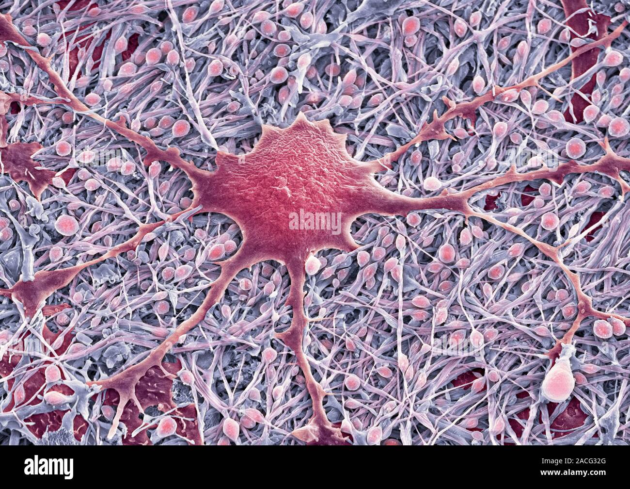 Glial cells. Coloured scanning electron micrograph (SEM) of a glial ...