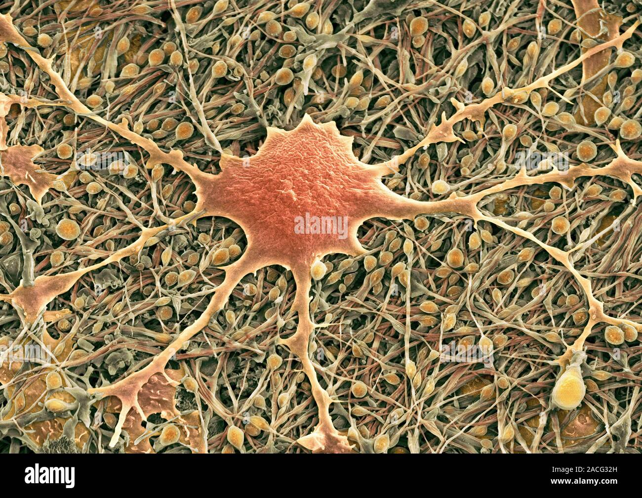 Glial cells. Coloured scanning electron micrograph (SEM) of a glial ...