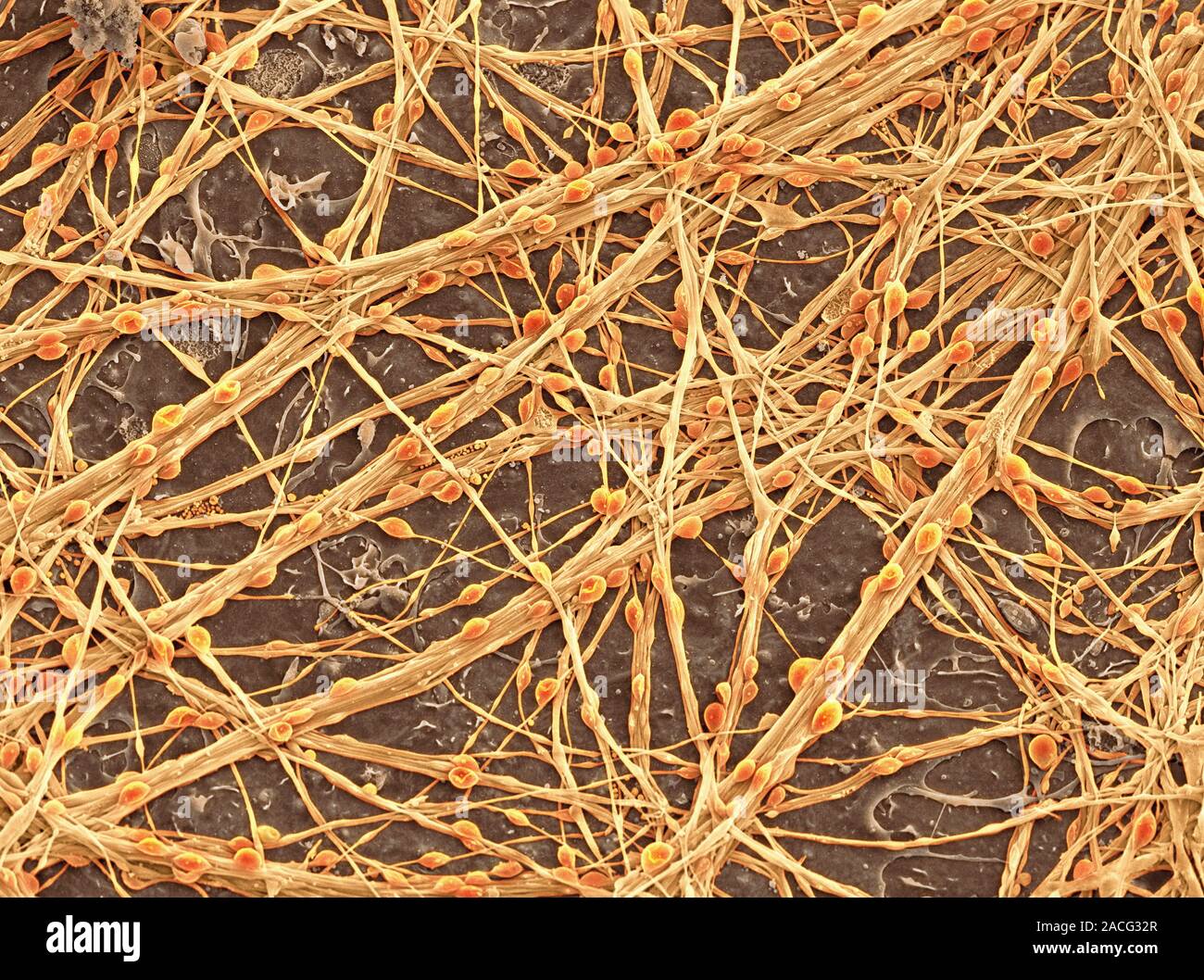 Nerve cells. Coloured scanning electron micrograph (SEM) of nerve cells ...