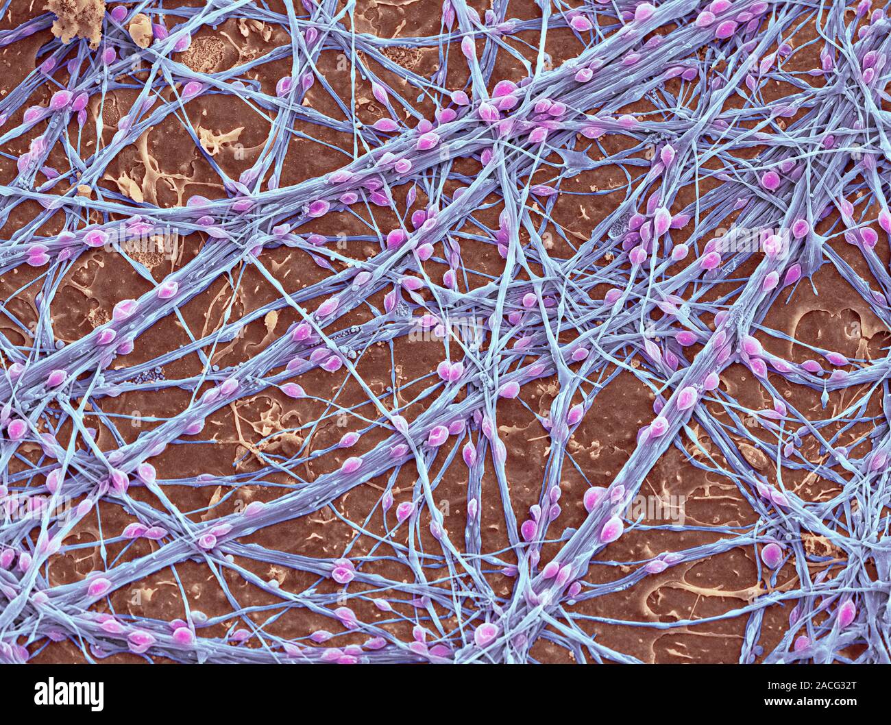 Nerve cells. Coloured scanning electron micrograph (SEM) of nerve cells ...