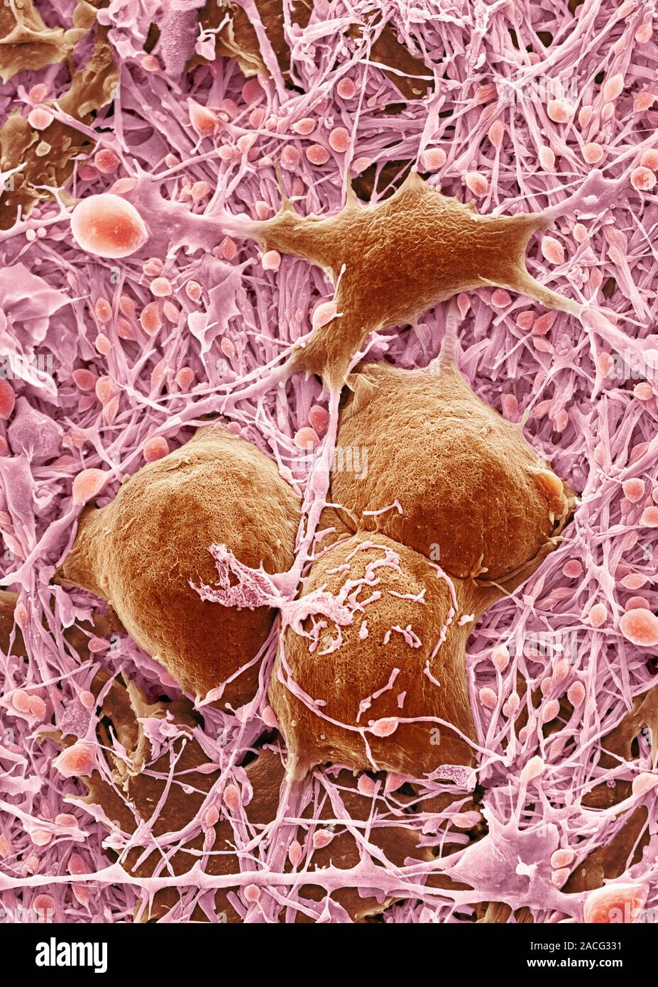 Nerve cells and glial cells, coloured scanning electron micrograph (SEM ...