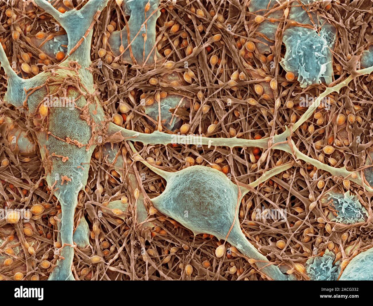 Nerve cells and glial cells. Coloured scanning electron micrograph (SEM ...