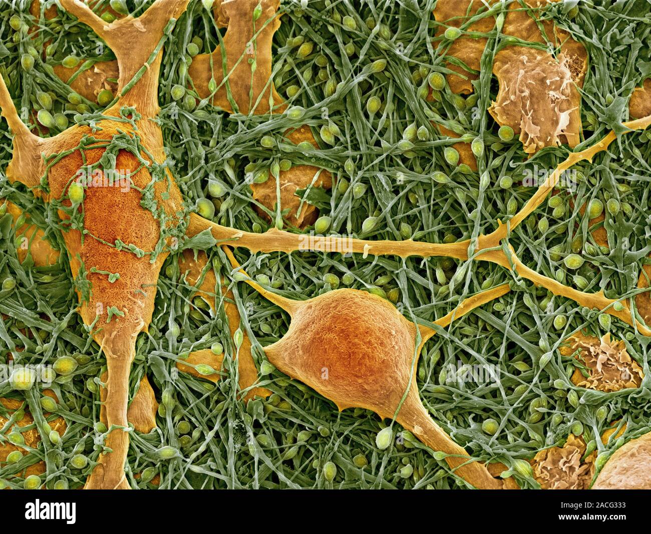 Nerve cells and glial cells. Coloured scanning electron micrograph (SEM ... Nerve cells and glial cells. Coloured scanning electron micrograph (SEM ...