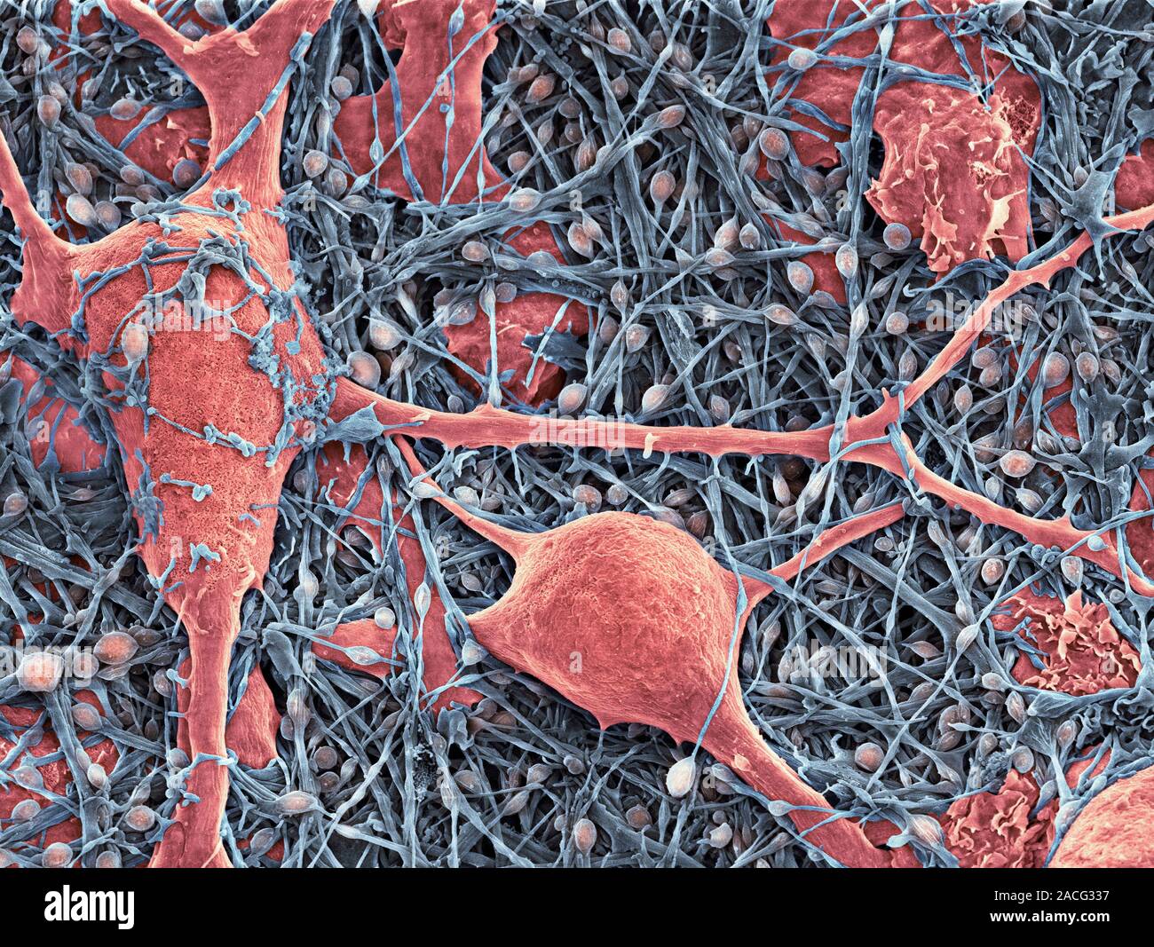 Nerve cells and glial cells. Coloured scanning electron micrograph (SEM ...