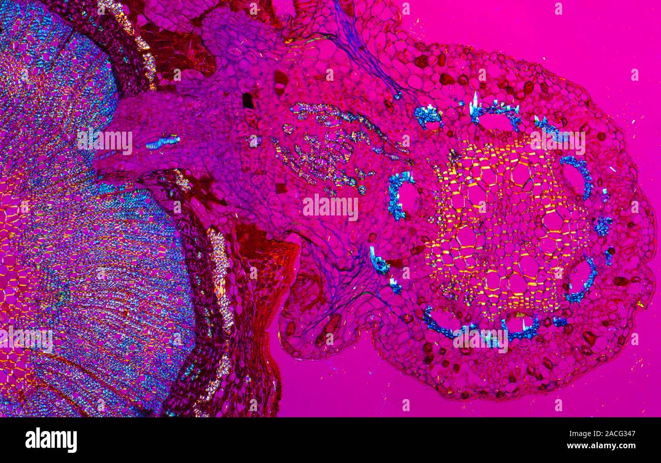 Plant parasite. Polarised light micrograph of a transverse section ...