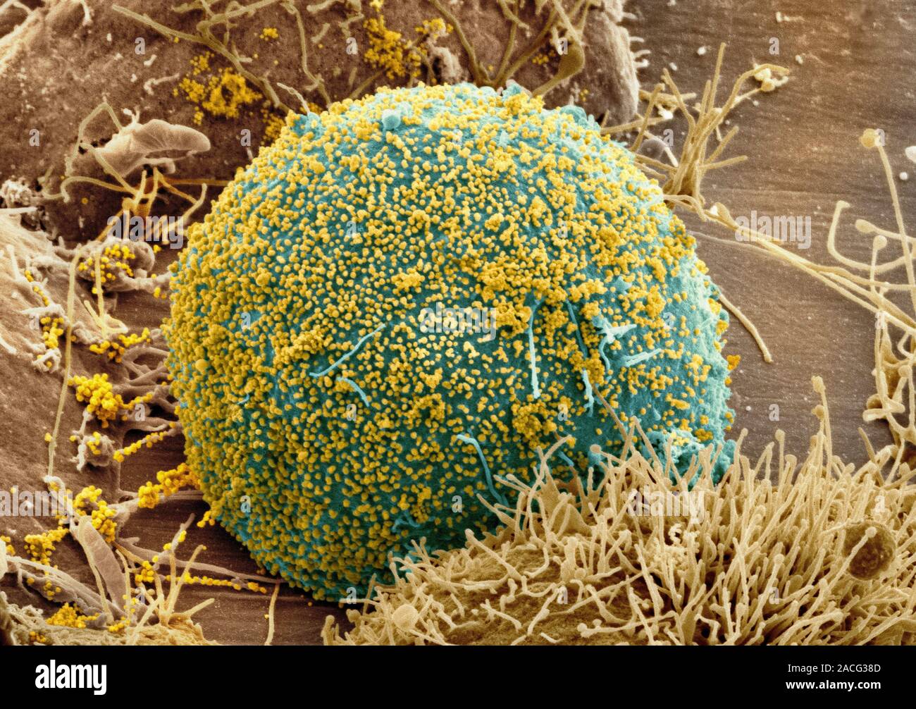 Cell infected with HIV. Coloured scanning electron micrograph (SEM) of ...
