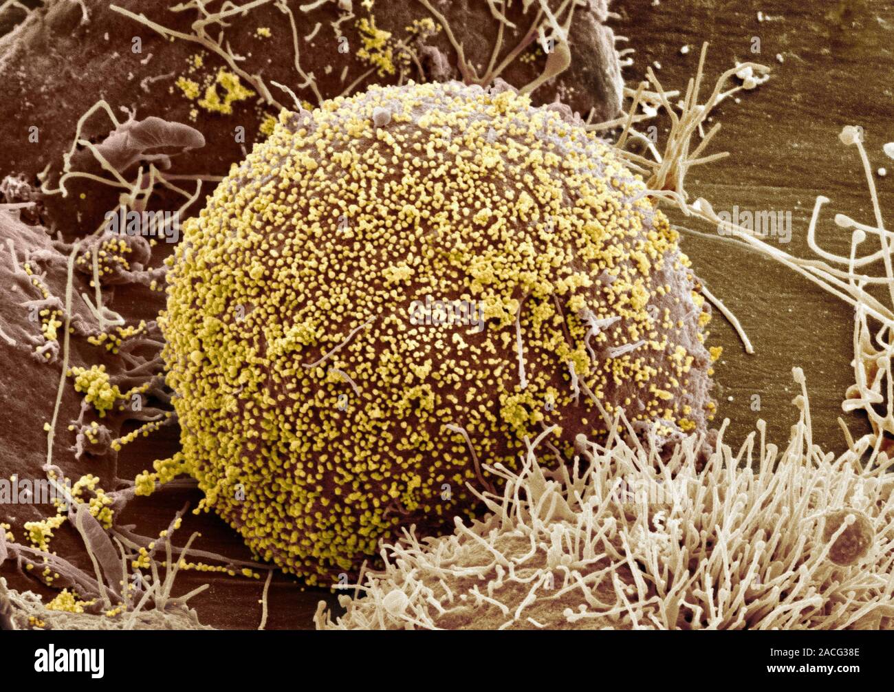 Cell infected with HIV. Coloured scanning electron micrograph (SEM) of ...
