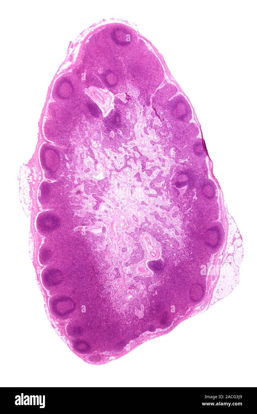 Healthy lymph node. Light micrograph of a section through a normal ...