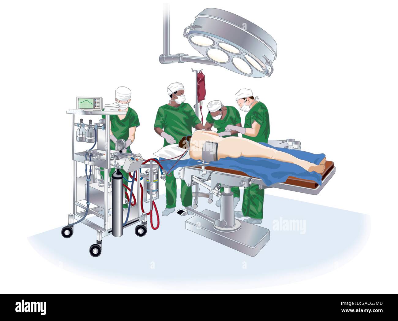 Surgery, computer artwork Stock Photo - Alamy
