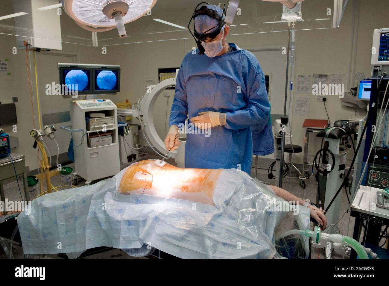Spinal surgery. Surgeon preparing the back of a patient for spinal ...