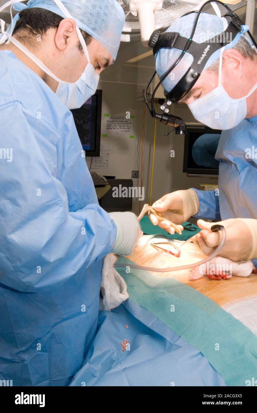 Spinal surgery. Surgeons operating on a patient's spine. The camera ...