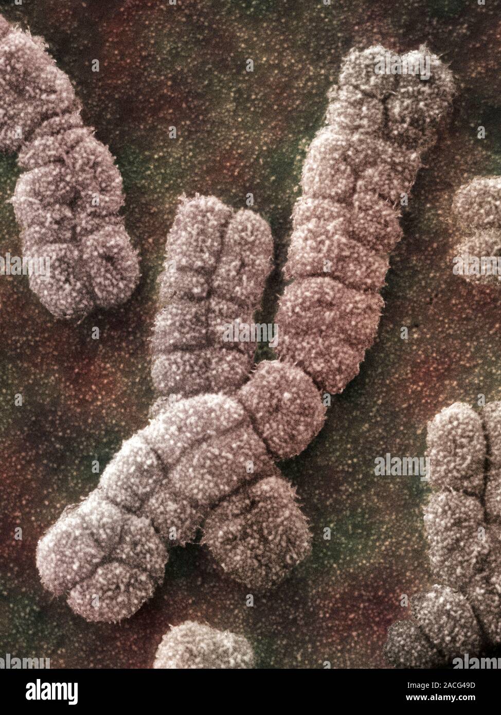 Human chromosomes, coloured scanning electron micrograph (SEM). Humans ...