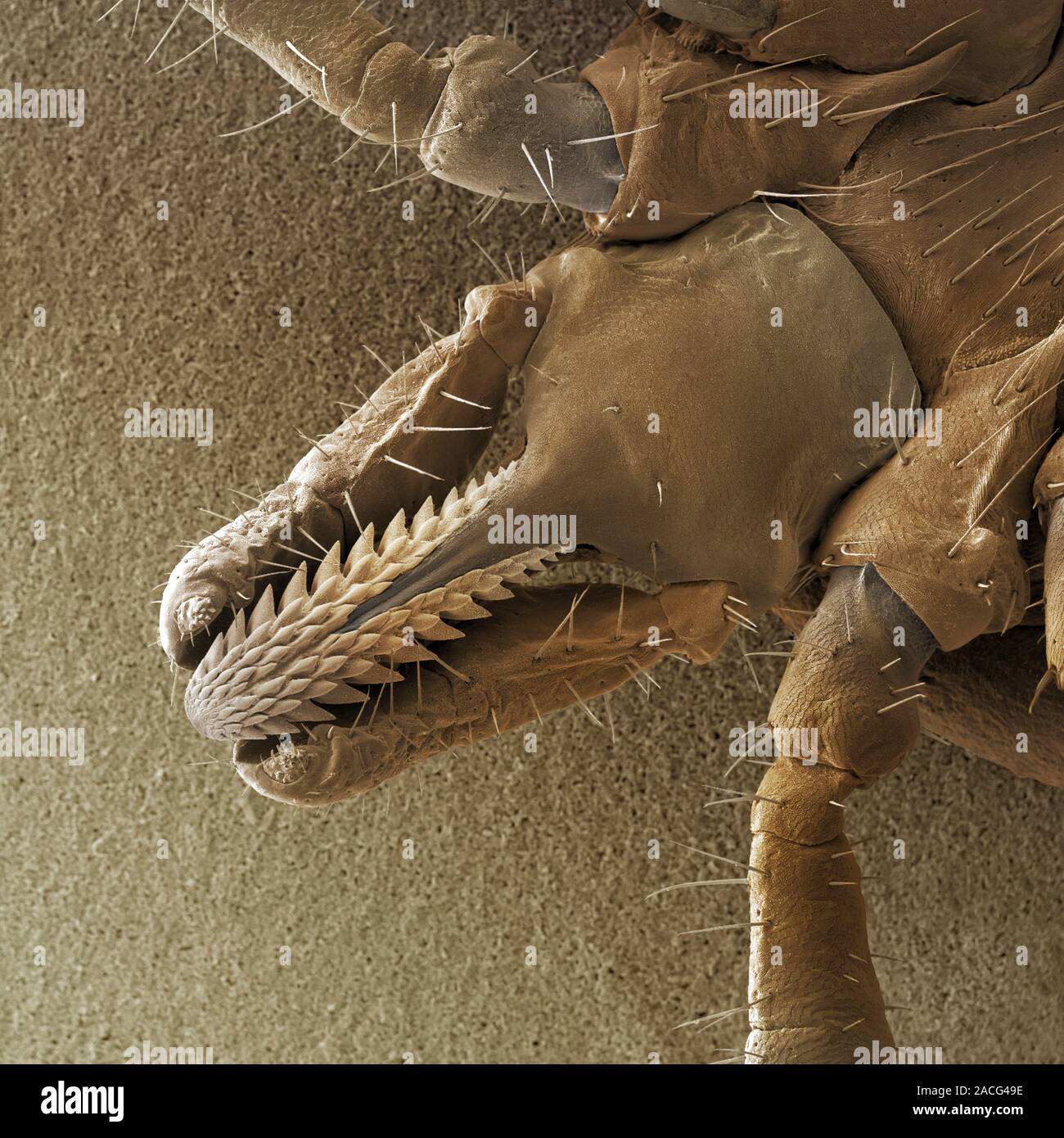 Sheep tick. Coloured scanning electron micrograph (SEM) of the ...