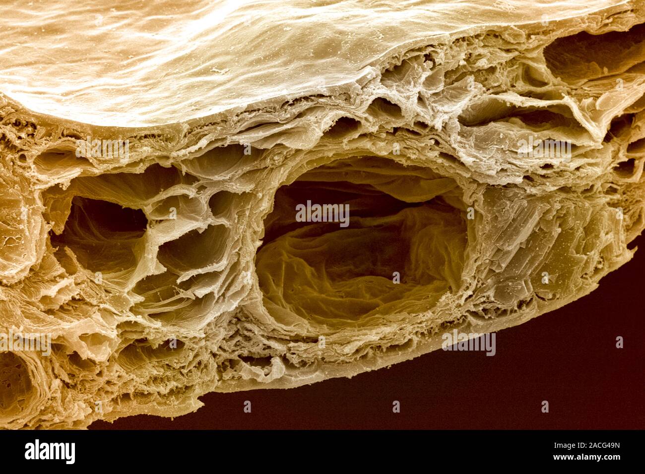 Clove flower petal. Coloured scanning electron micrograph (SEM) of a ...