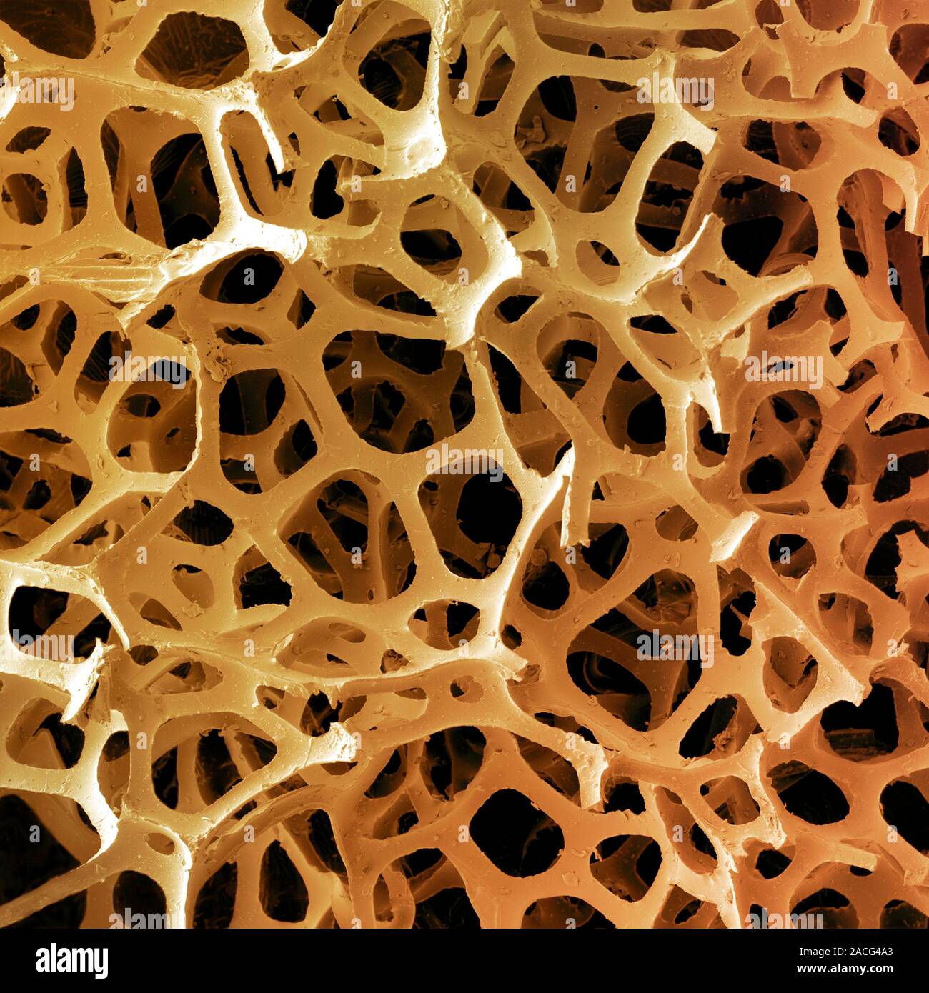 Synthetic sponge. Coloured scanning electron micrograph (SEM) showing ...