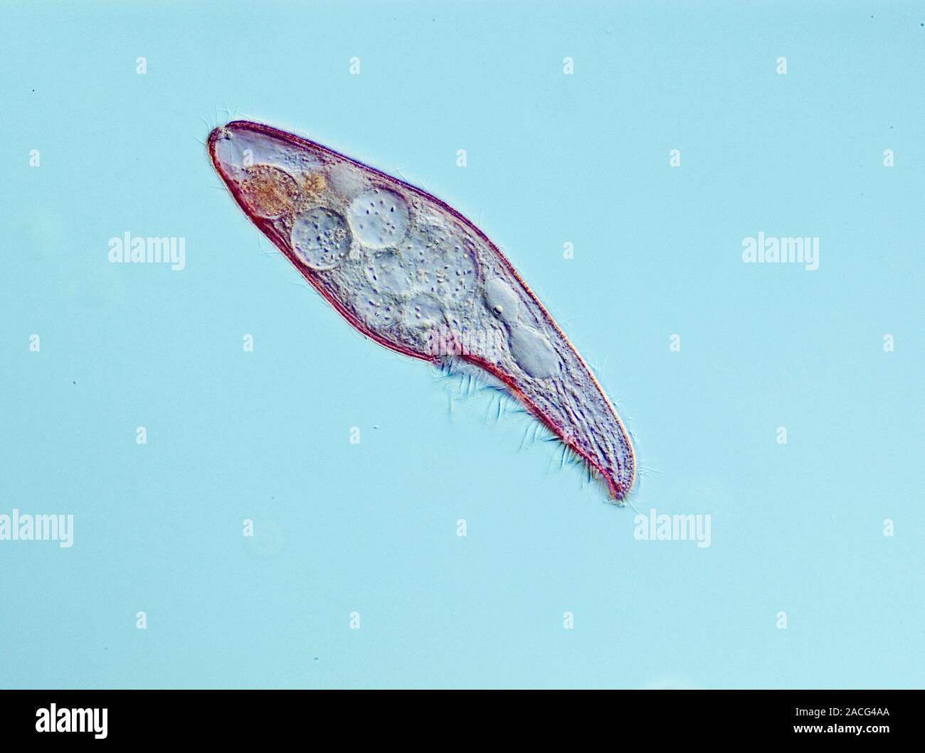 Blepharisma protozoan. Differential interference contrast micrograph of ...