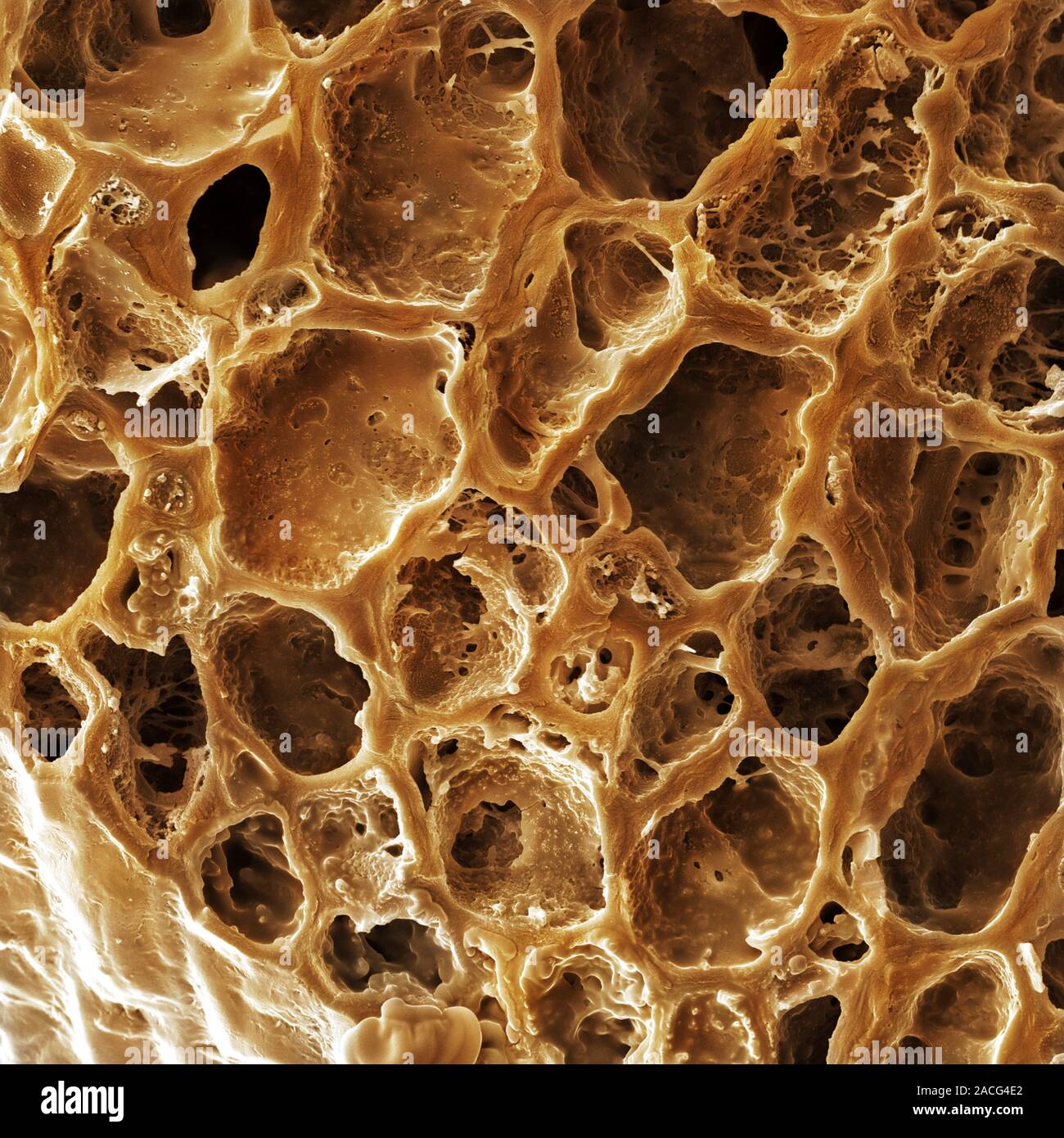 Roasted coffee bean. Coloured scanning electron micrograph (SEM) of a ...