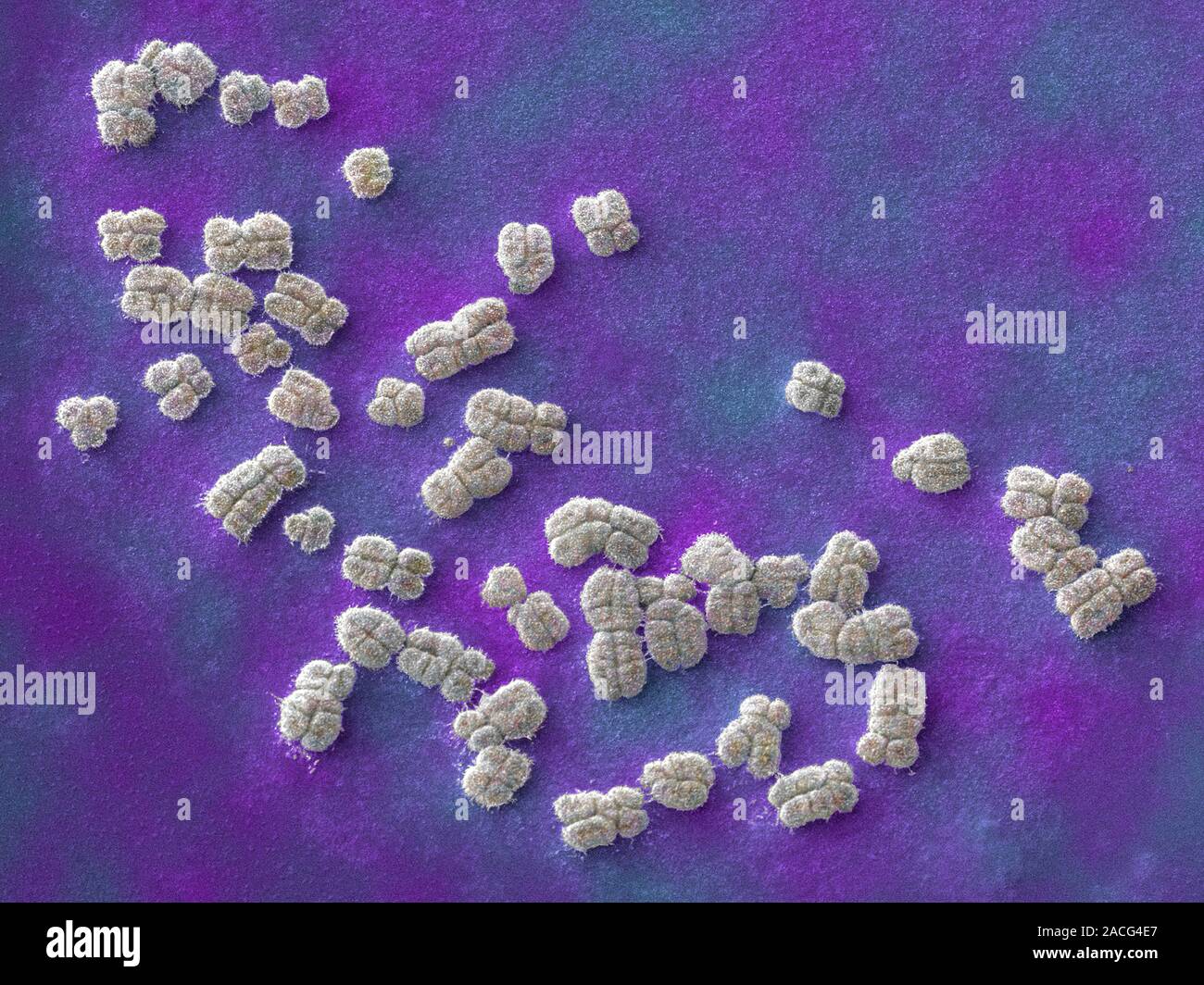 Set of human chromosomes, coloured scanning election micrograph (SEM ...