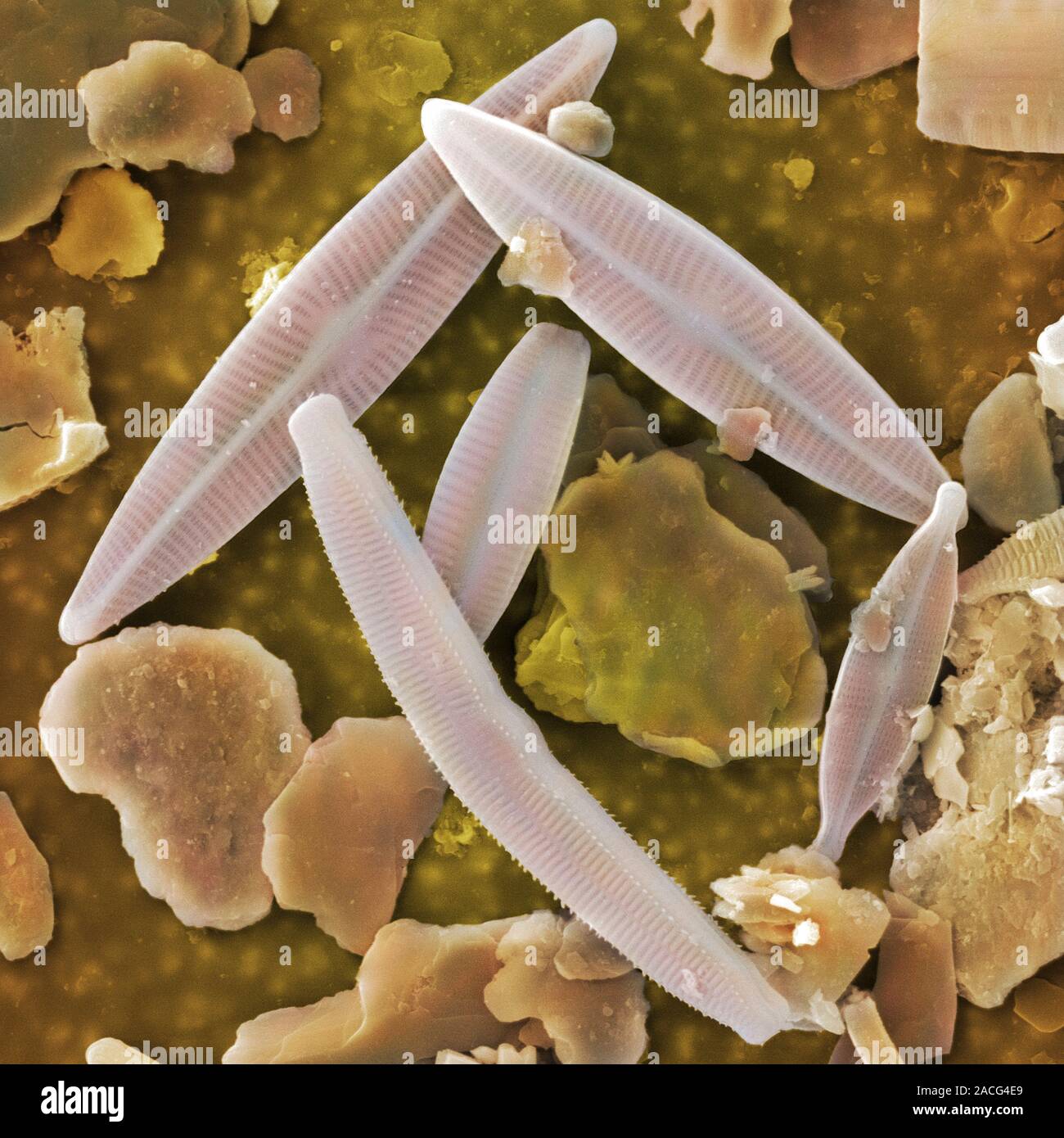 Diatoms. Coloured scanning electron micrograph (SEM) of Epithemia and ...