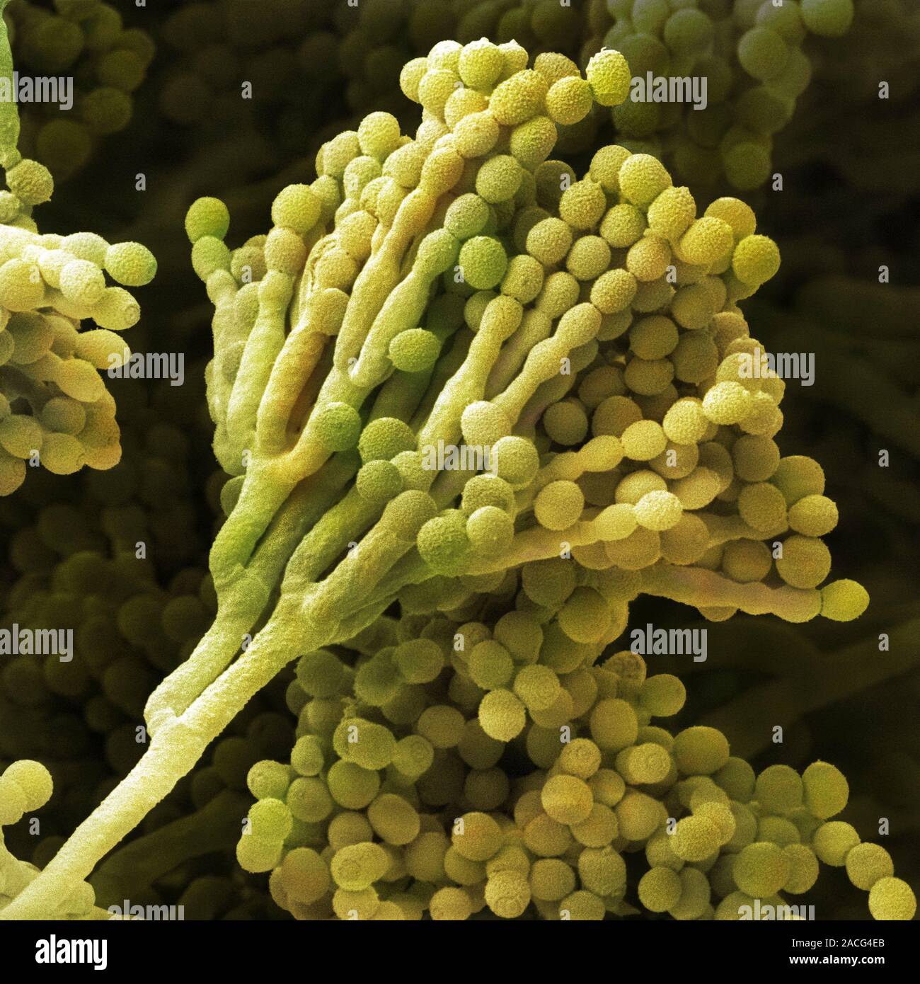 Mould fungus (Penicillium expansum), coloured scanning electron micrograph (SEM). This fungus ...