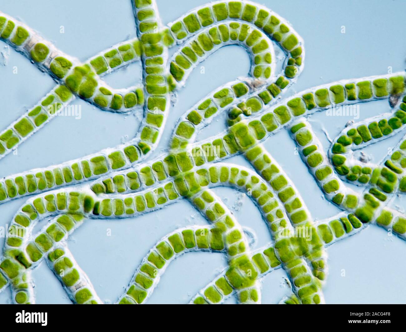 Green algae. Differential interference contrast light micrograph of the ...